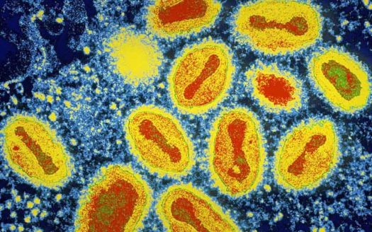 Variole : des scientifiques recréent le dangereux virus avec de l'ADN ...